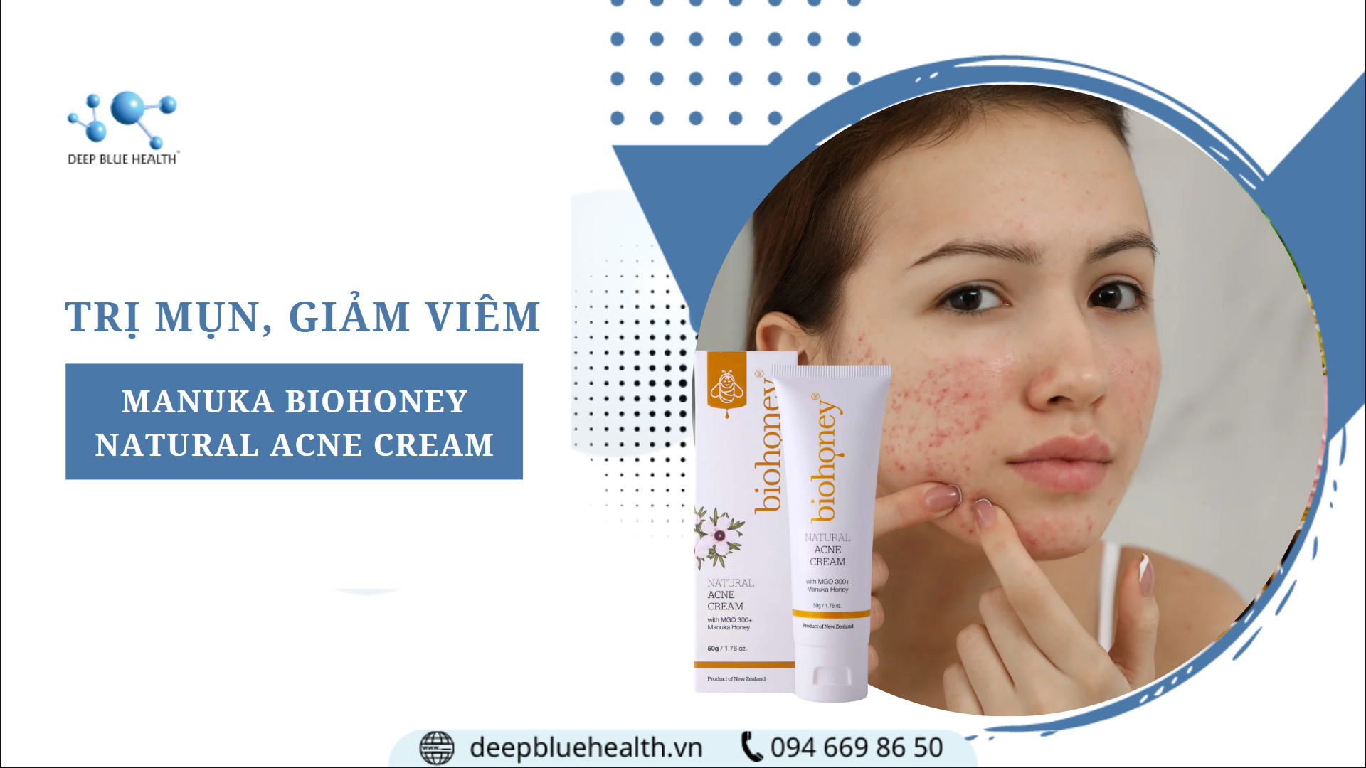 Trị mụn, giảm viêm hiệu quả nhờ Manuka Biohoney Natural Acne Cream ...